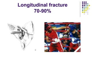 Ct scan of temporal bone 2nd lecture | PPT