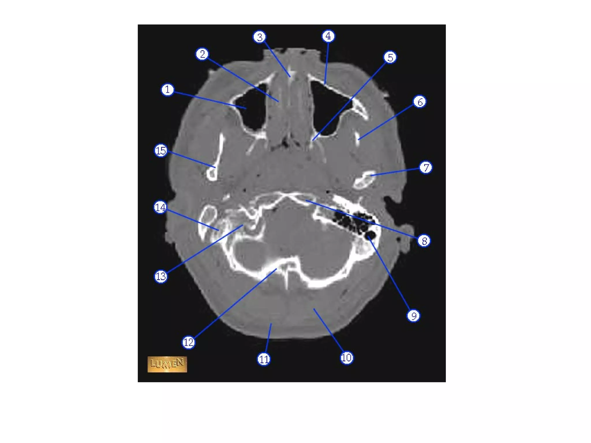 Ct Sections Head | PPT