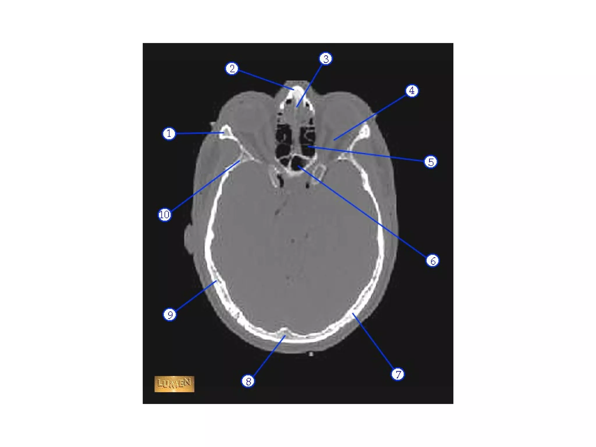 Ct Sections Head | PPT