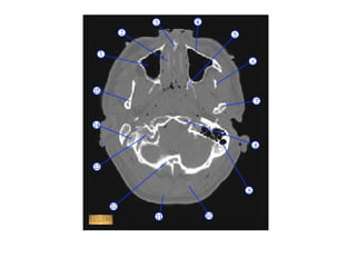 Ct Sections Head | PPT