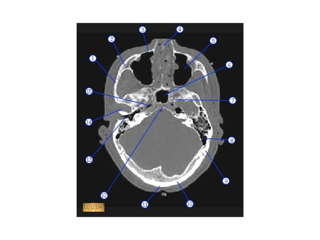 Ct Sections Head | PPT