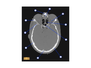 Ct Sections Head | PPT