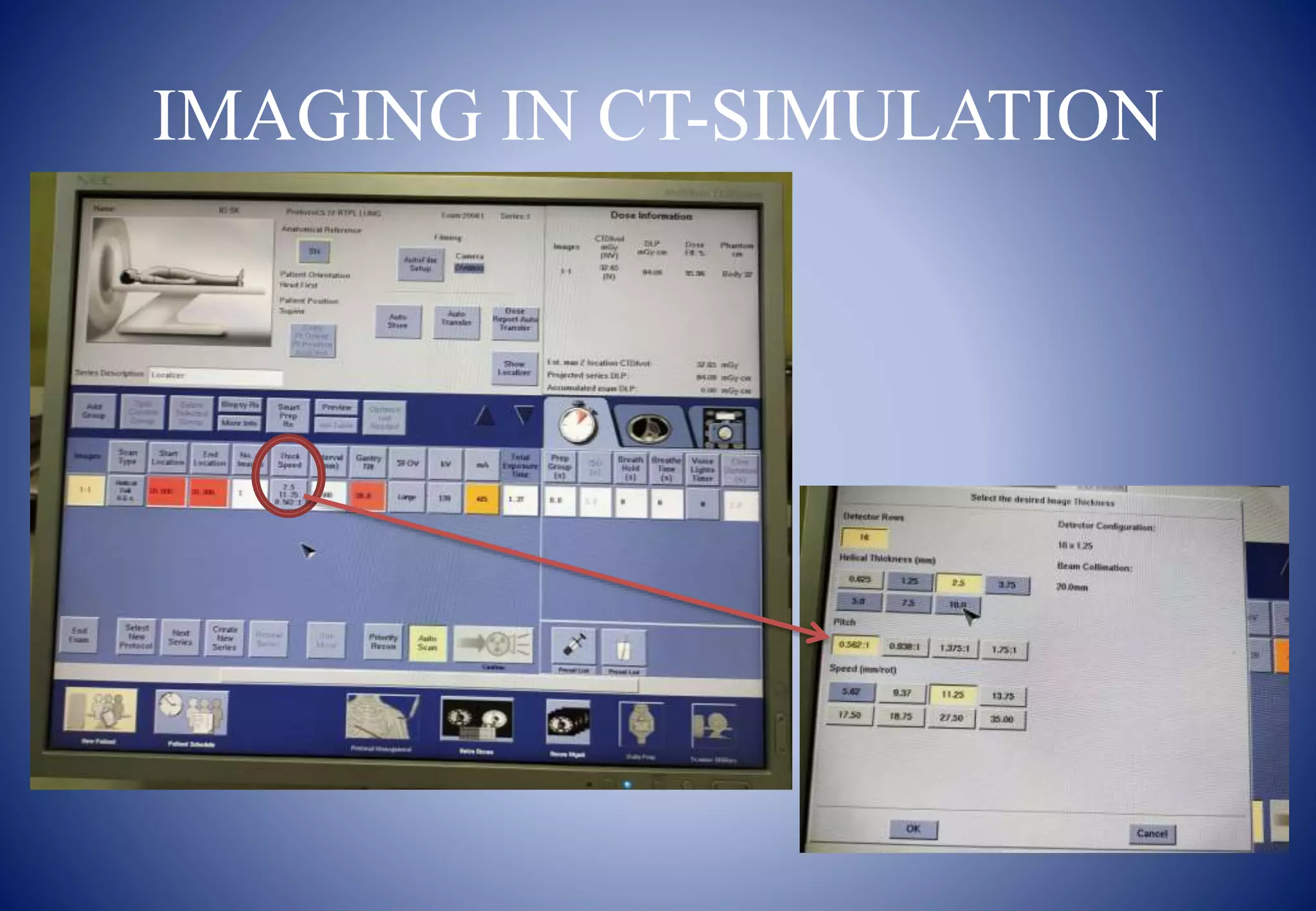 Importance of Planning CT Simulation(3D) in Radiothrapy/Radiation ...