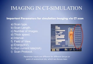 Importance of Planning CT Simulation(3D) in Radiothrapy/Radiation ...