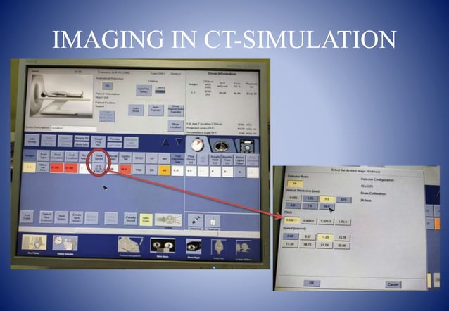Importance of Planning CT Simulation(3D) in Radiothrapy/Radiation ...