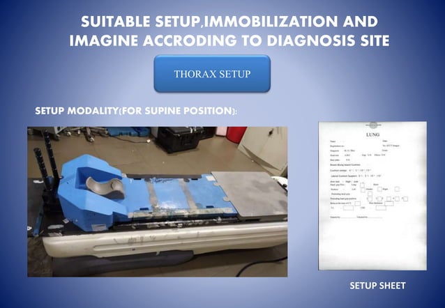 Importance of Planning CT Simulation(3D) in Radiothrapy/Radiation ...
