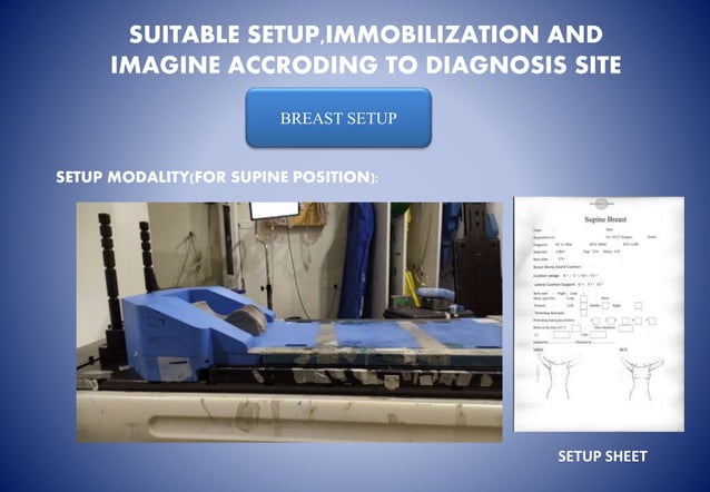 Importance of Planning CT Simulation(3D) in Radiothrapy/Radiation ...