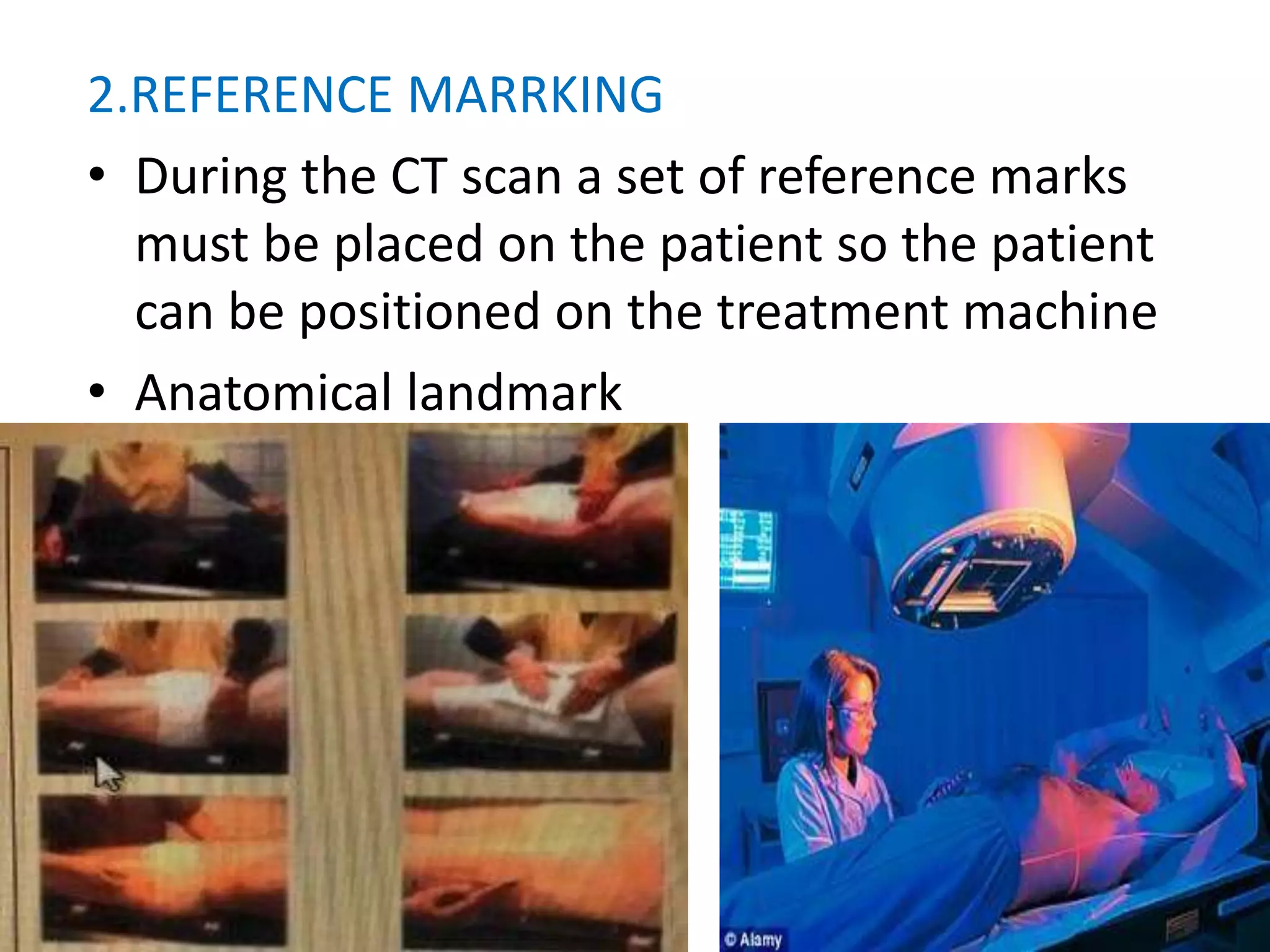 importance of ct-simulator in radiotherapy | PPTX