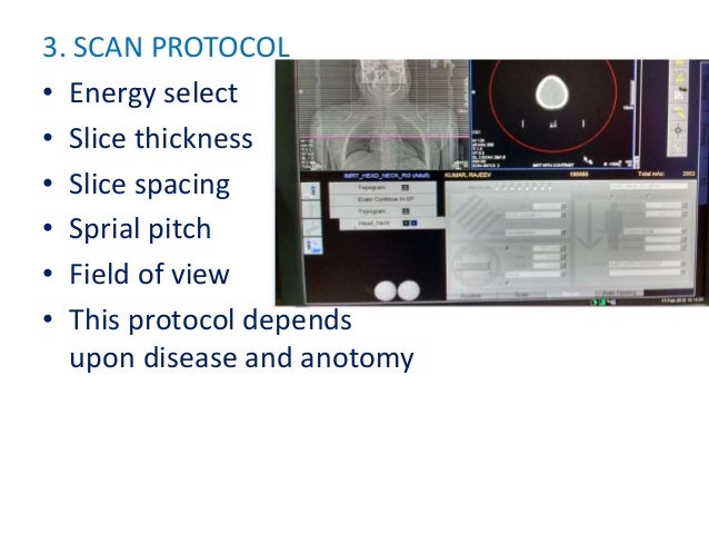 importance of ct-simulator in radiotherapy