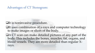 Ct stonogram-final-slide-share (Amponin & Carampatan) | PPTX