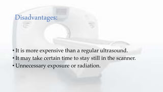 Ct stonogram-final-slide-share (Amponin & Carampatan) | PPTX