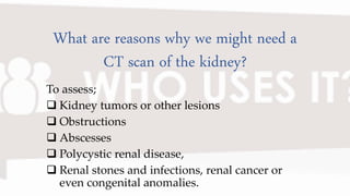 Ct stonogram-final-slide-share (Amponin & Carampatan) | PPTX