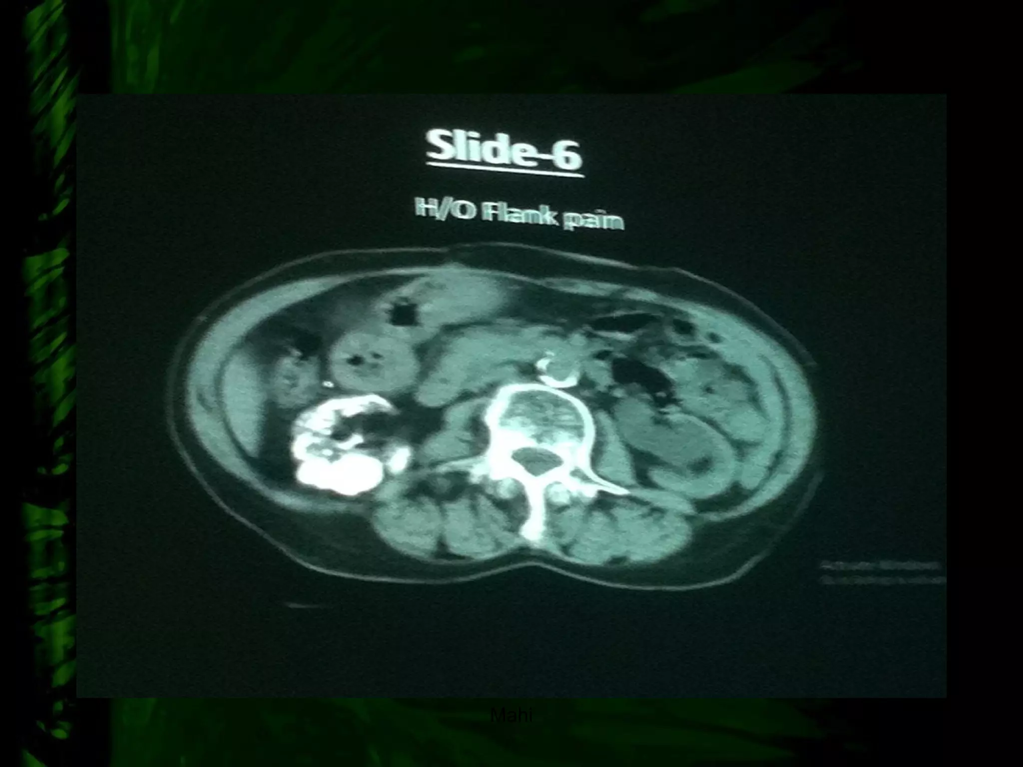 Ct urinary system in radiology | PPT