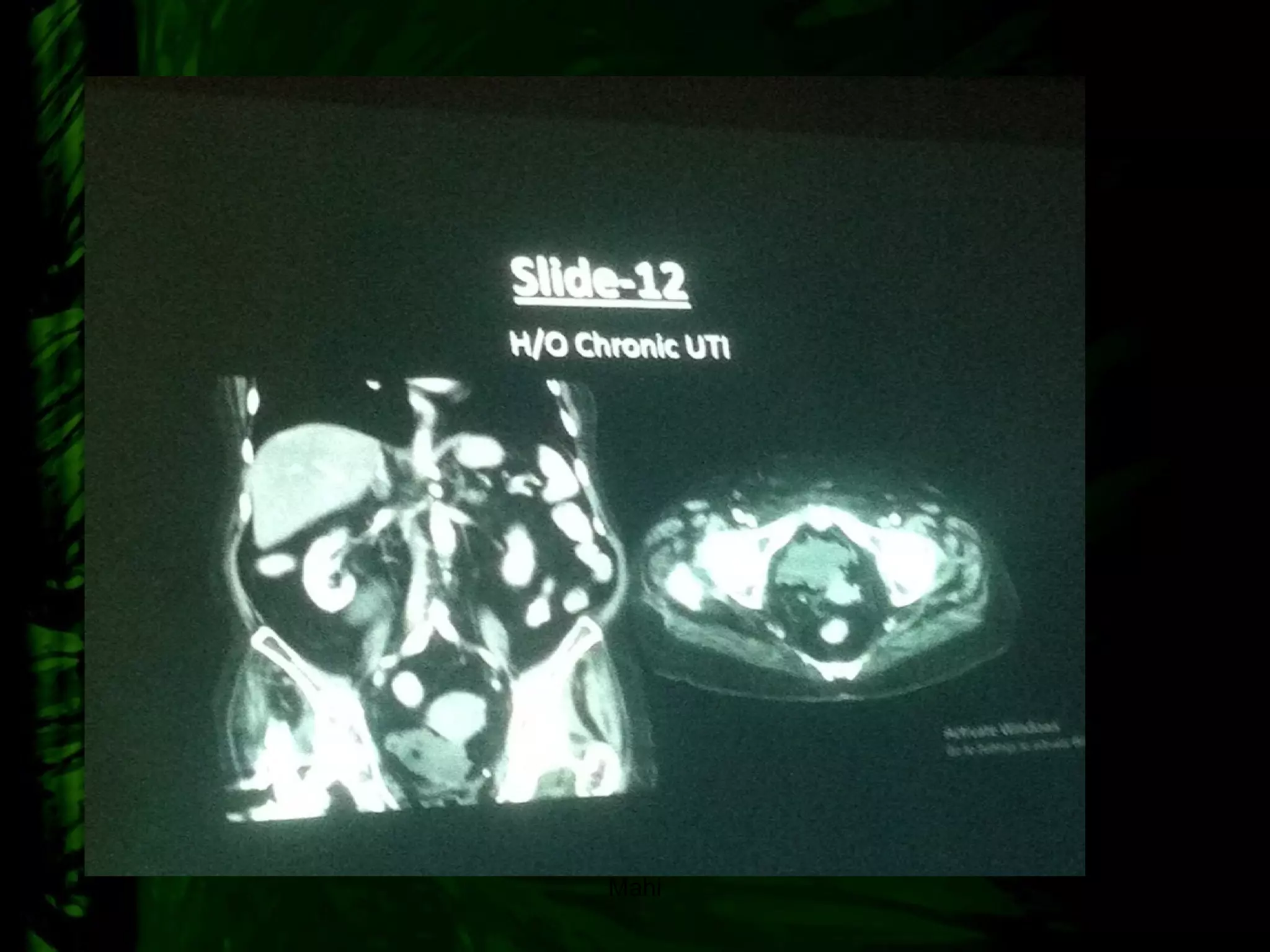 Ct urinary system in radiology | PPT