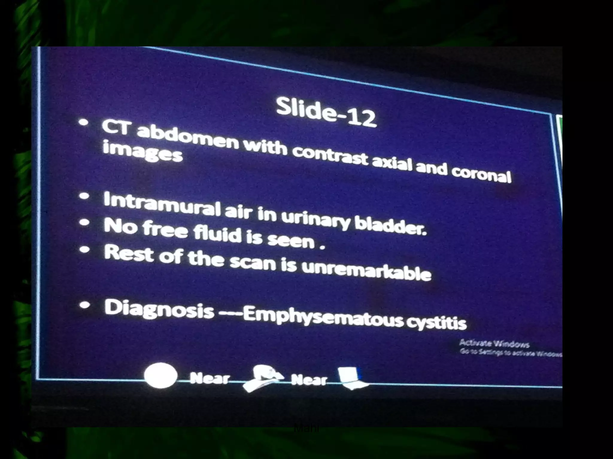Ct urinary system in radiology | PPT