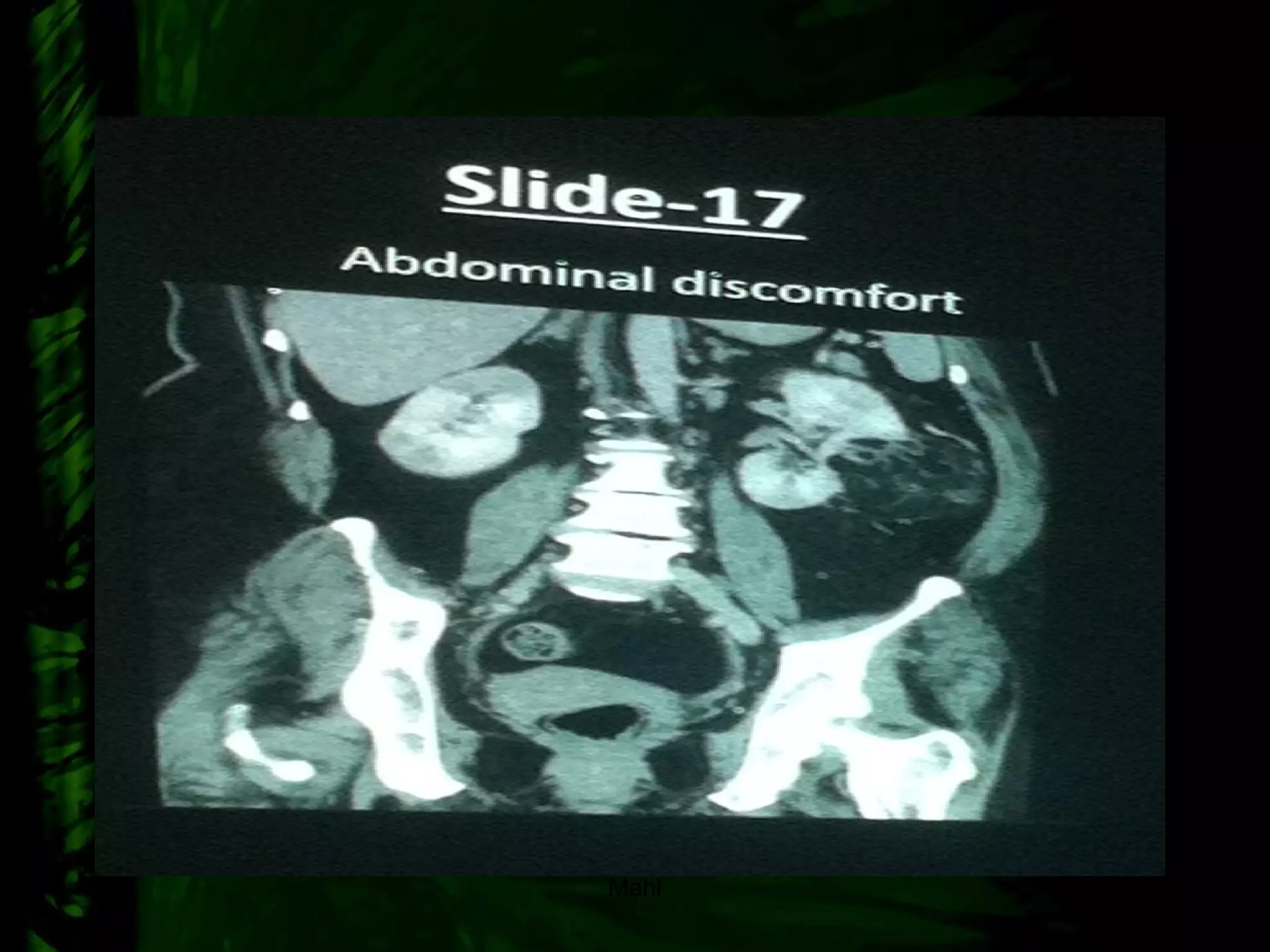Ct urinary system in radiology | PPT