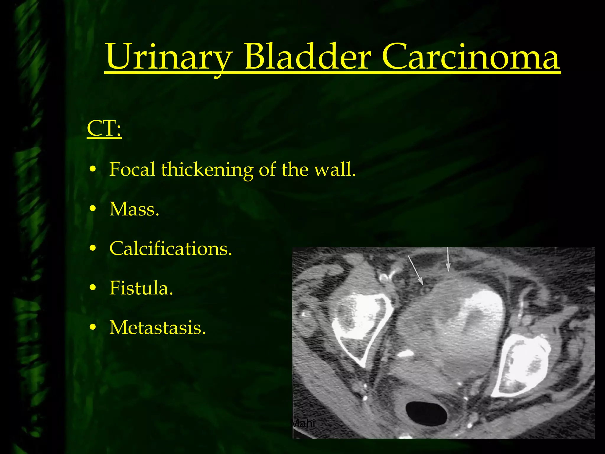 Ct urinary system in radiology | PPT