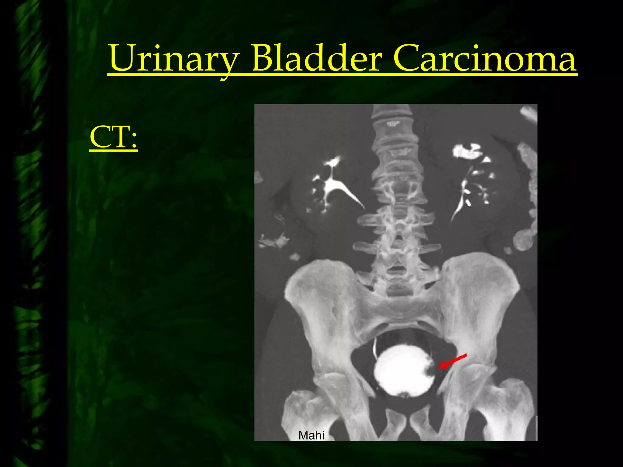 Ct urinary system in radiology | PPT