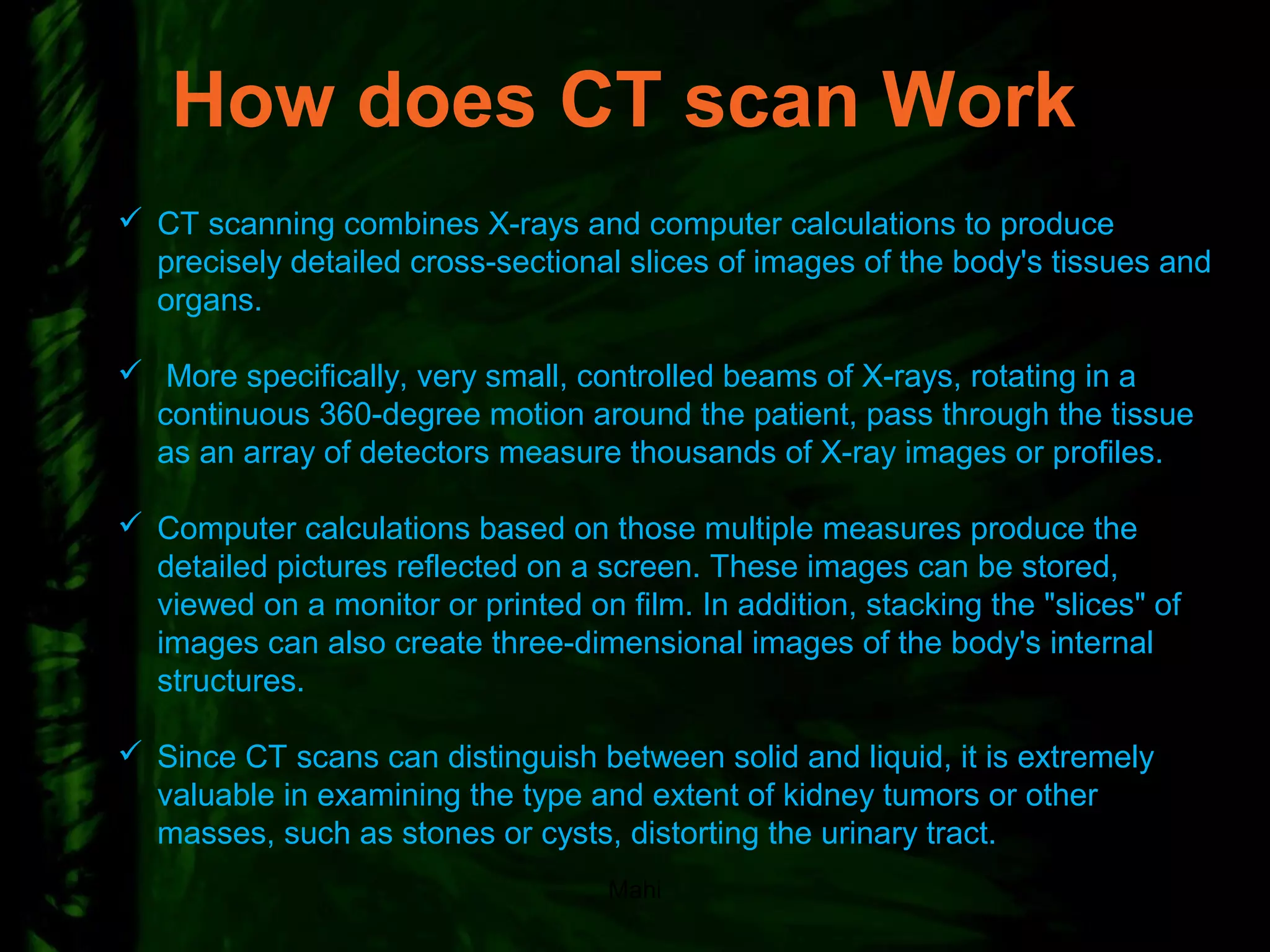 Ct urinary system in radiology | PPT