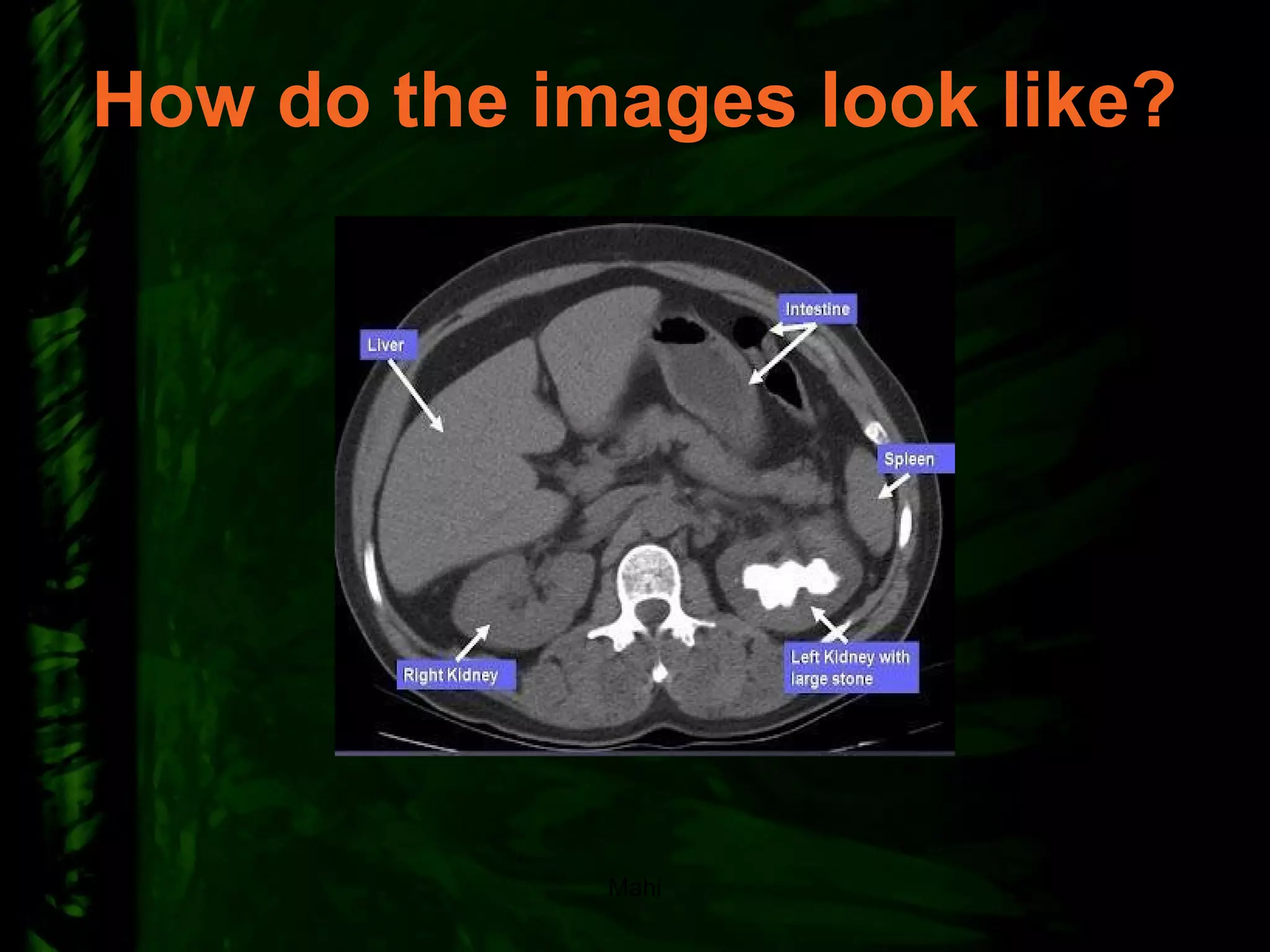 Ct urinary system in radiology | PPT