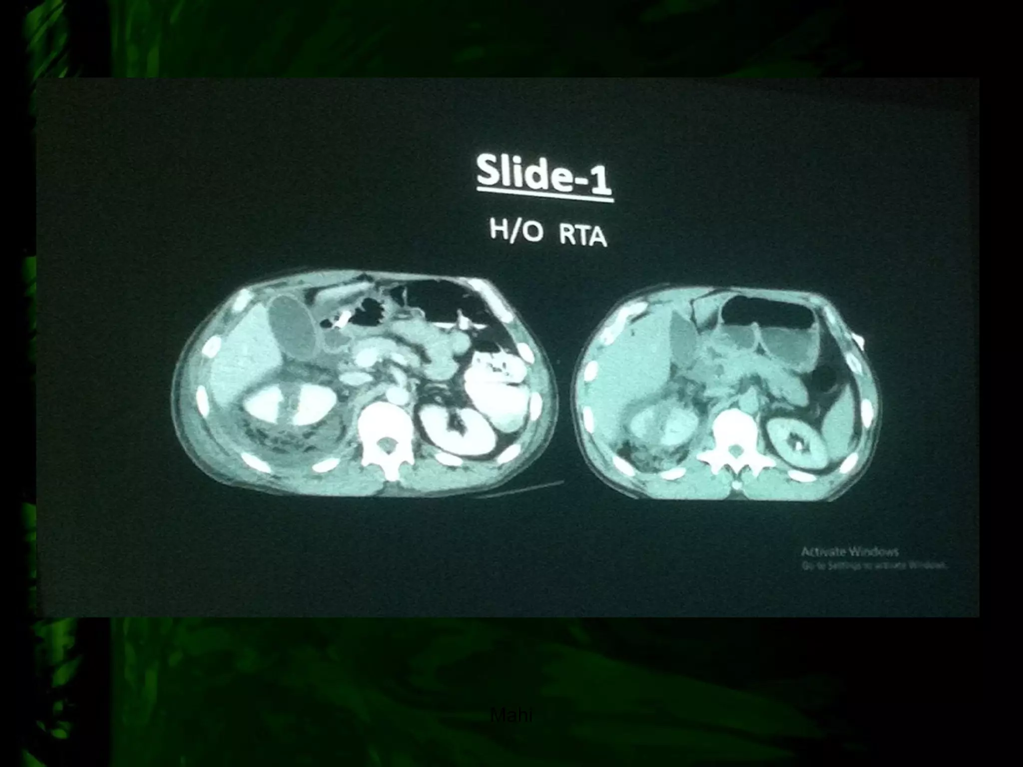 Ct urinary system in radiology | PPT