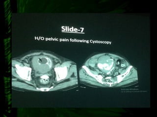 Ct urinary system in radiology | PPT