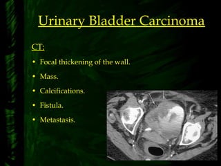Ct urinary system in radiology | PPT