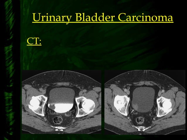 Ct urinary system in radiology | PPT