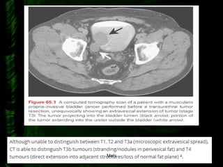 Ct urinary system in radiology | PPT