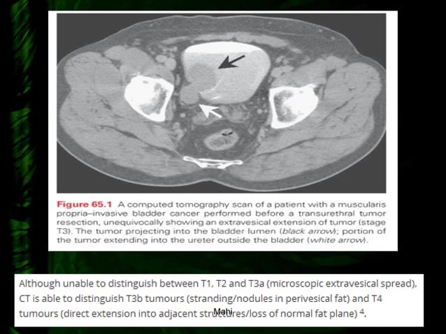Ct urinary system in radiology | PPT
