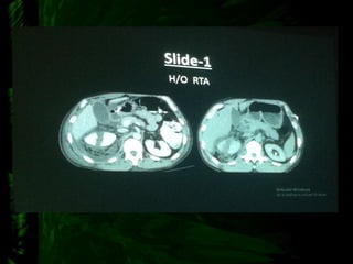 Ct urinary system in radiology | PPT