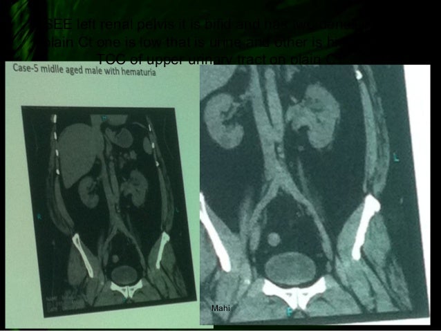 Ct urinary system in radiology