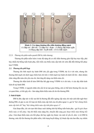 Ct vt đông mach chi | PDF