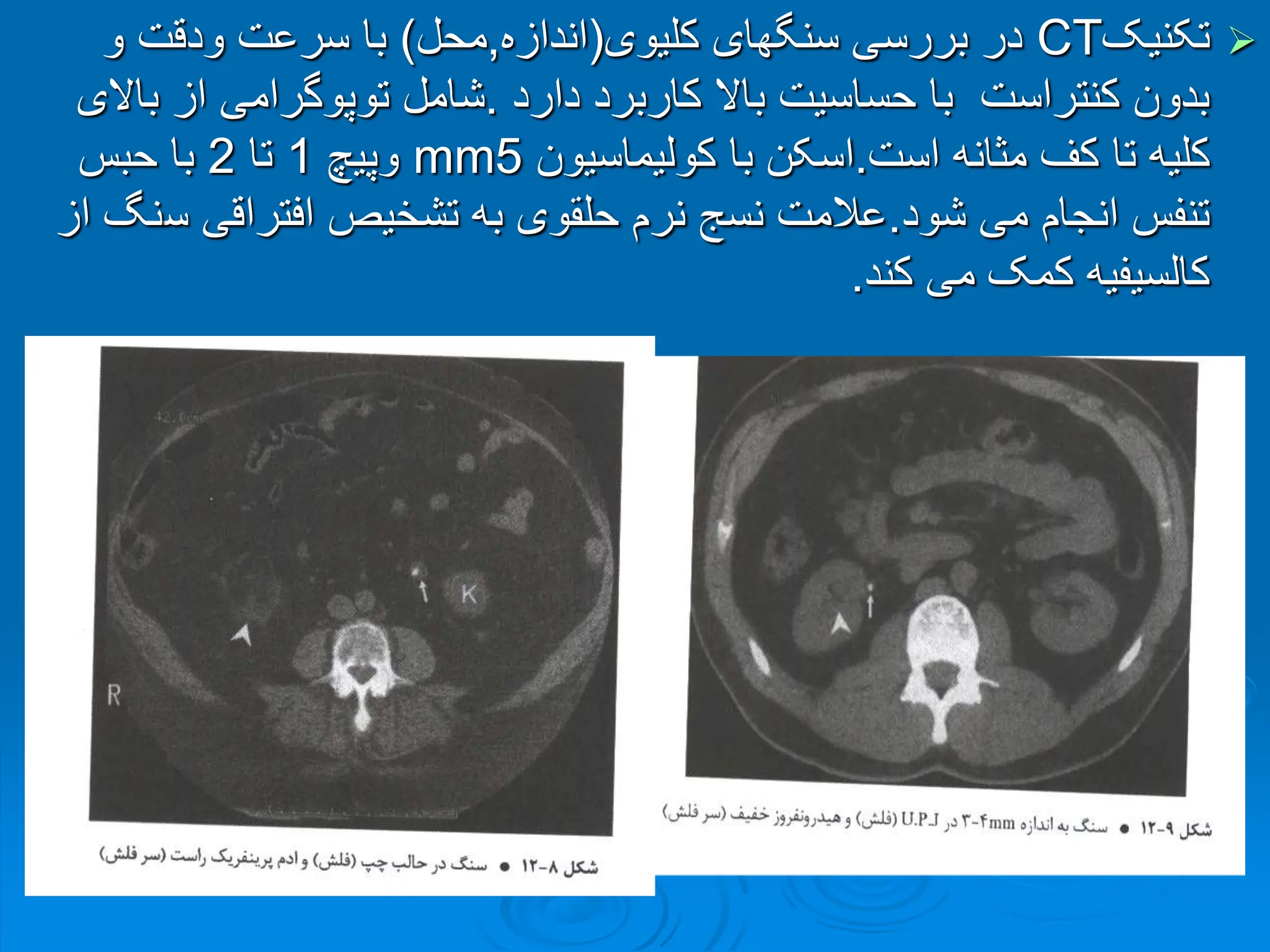 CT scan ABDOMEN Explained توضیحات سی تی اسکن شکم ولگن.ppt