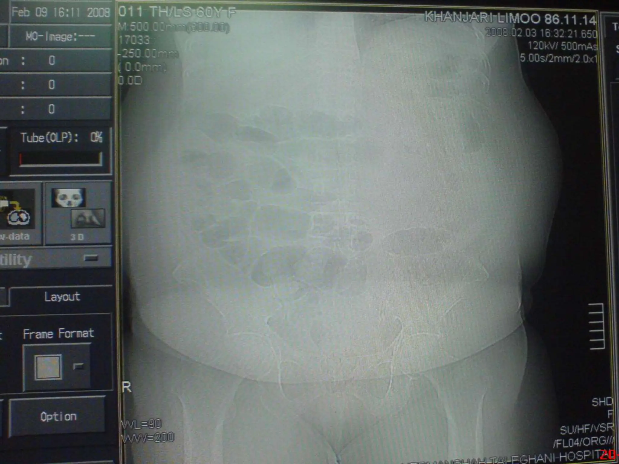 CT scan ABDOMEN Explained توضیحات سی تی اسکن شکم ولگن.ppt