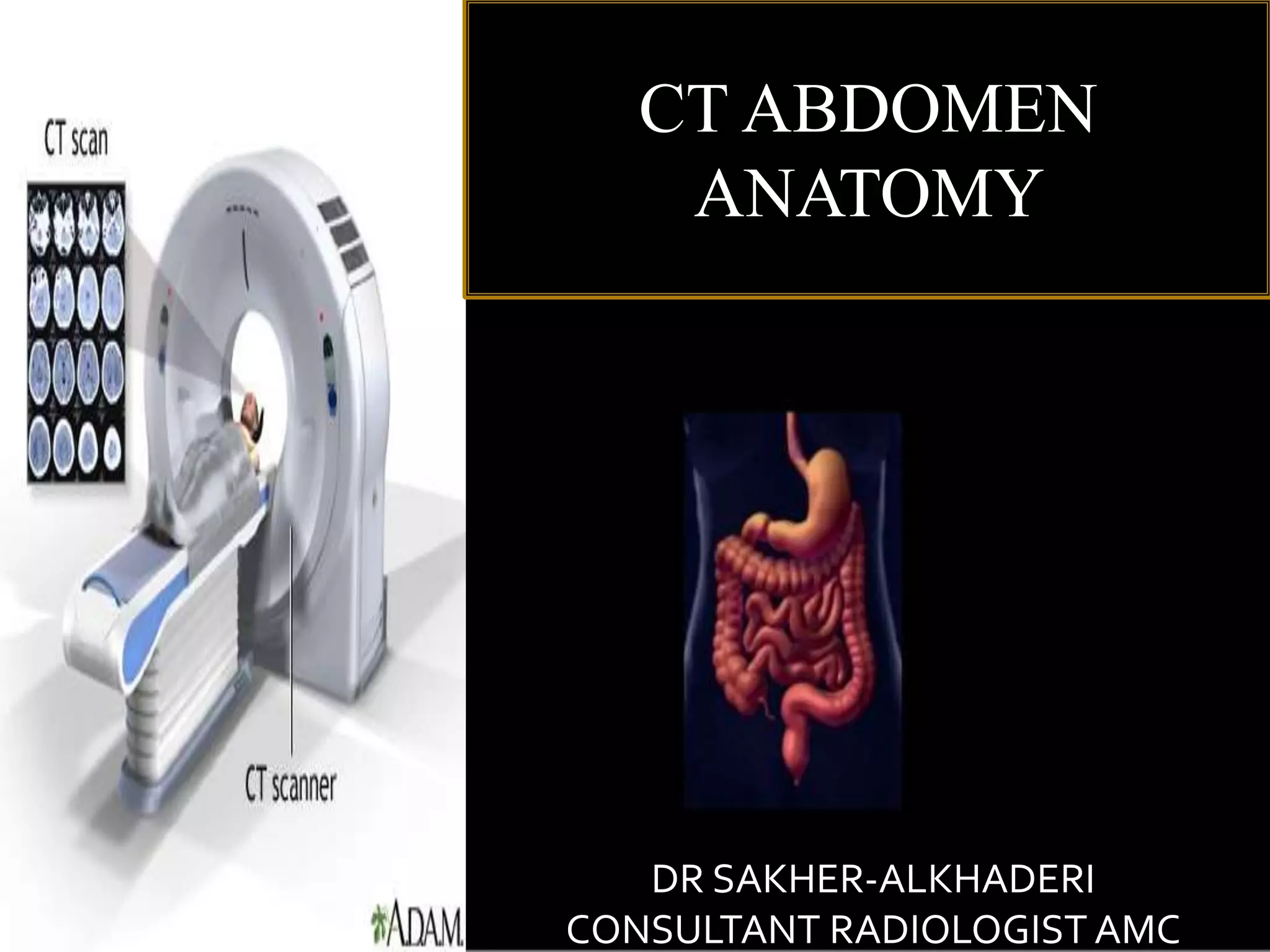CT ABDOMEN ANATOMY | PPTX