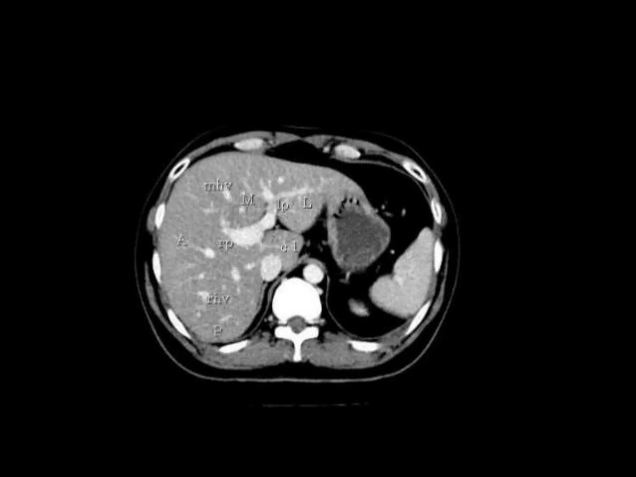 CT ABDOMEN ANATOMY | PPTX