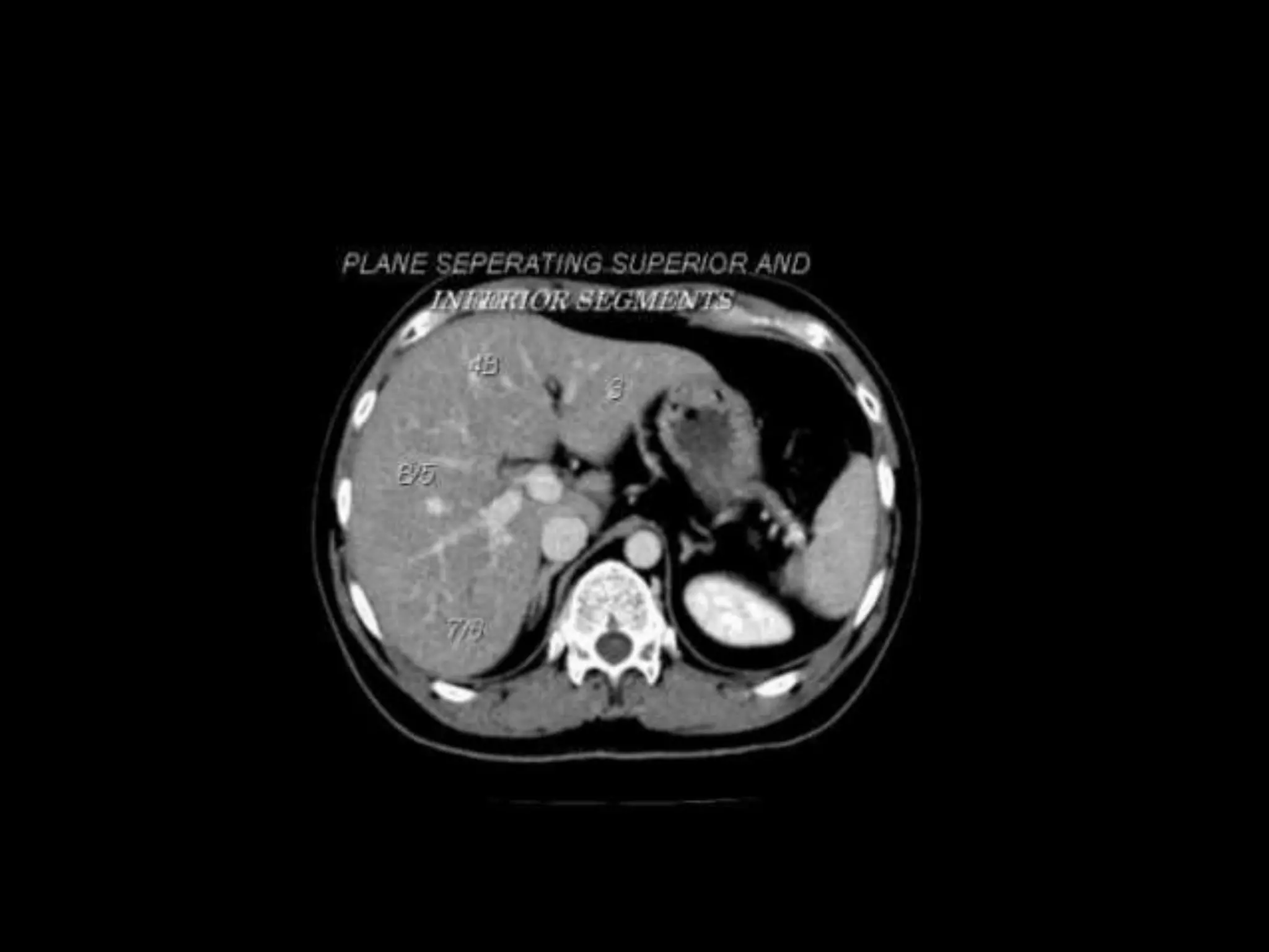 CT ABDOMEN ANATOMY | PPTX