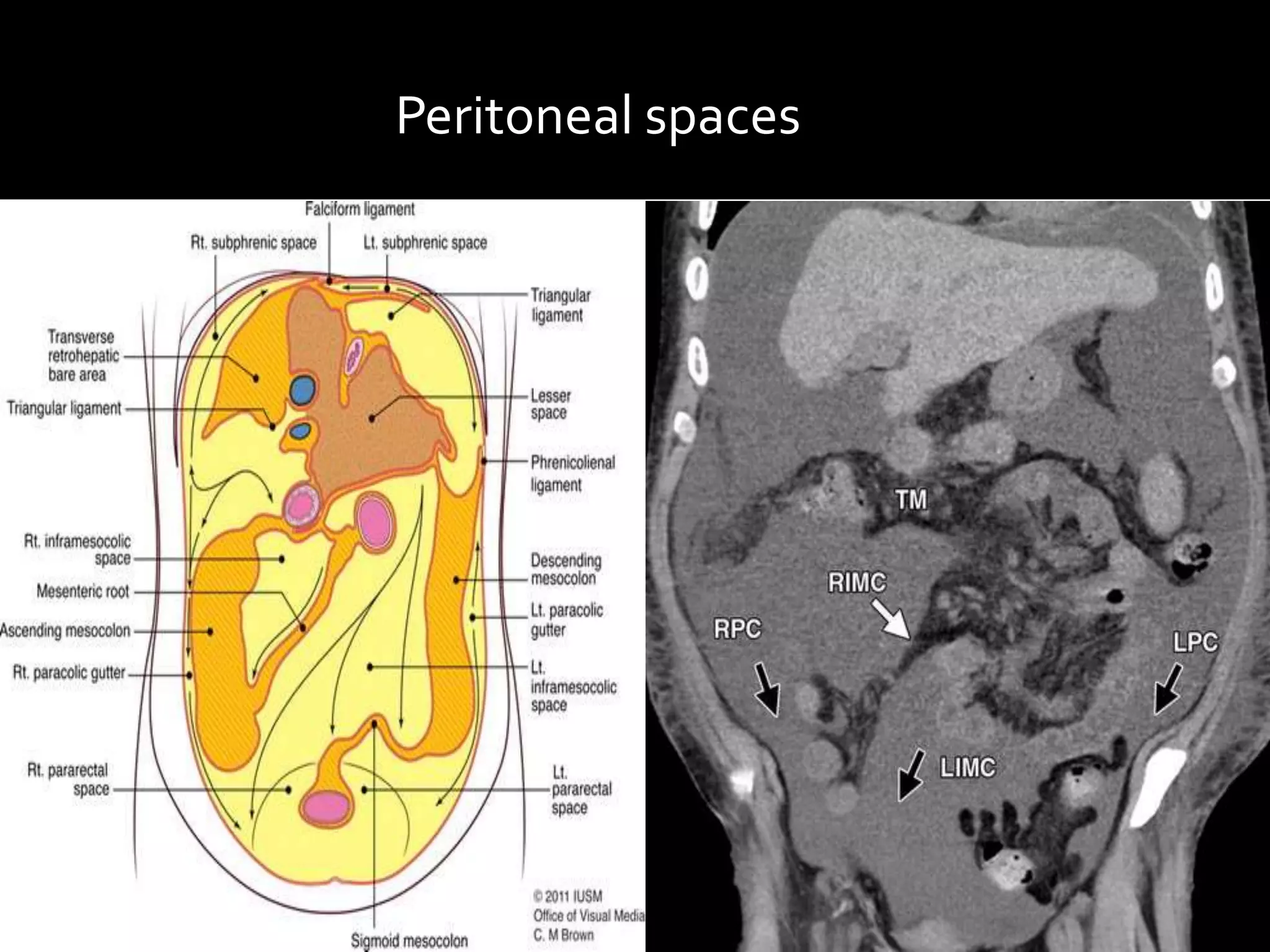 CT ABDOMEN ANATOMY | PPTX