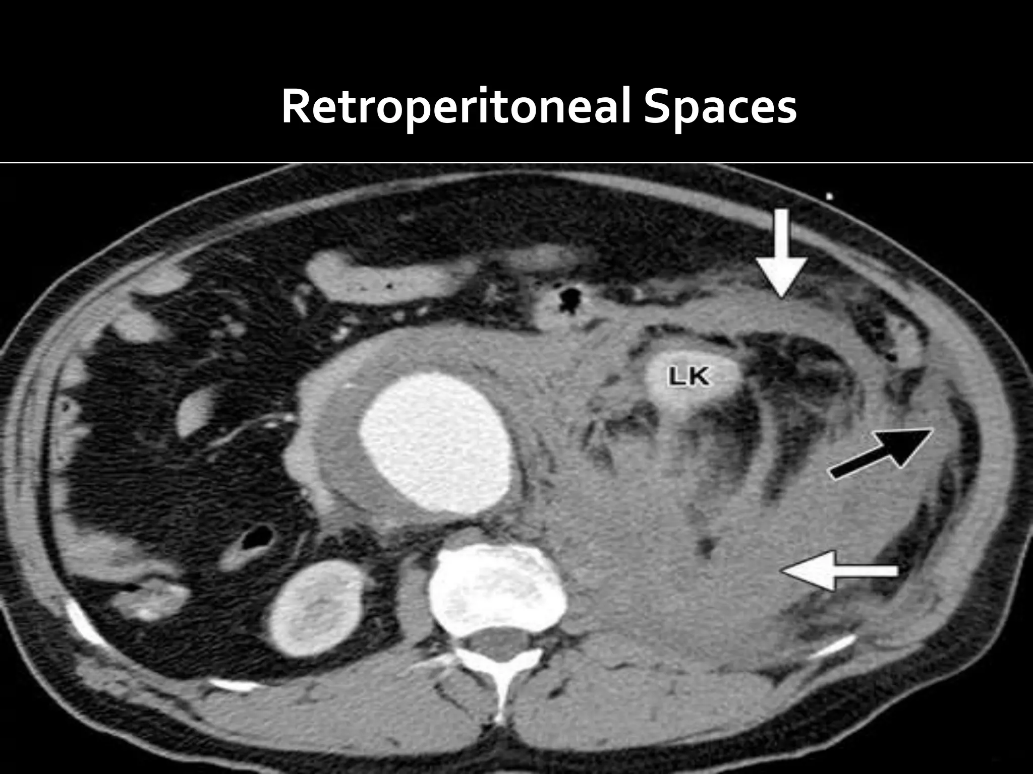 CT ABDOMEN ANATOMY | PPTX