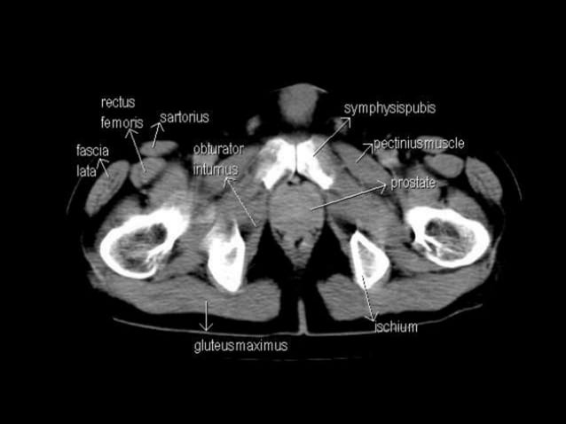 CT ABDOMEN ANATOMY | PPTX