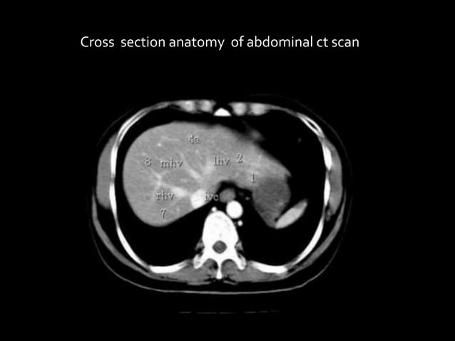 CT ABDOMEN ANATOMY | PPTX