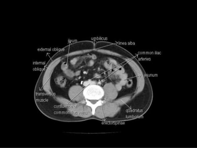 CT ABDOMEN ANATOMY