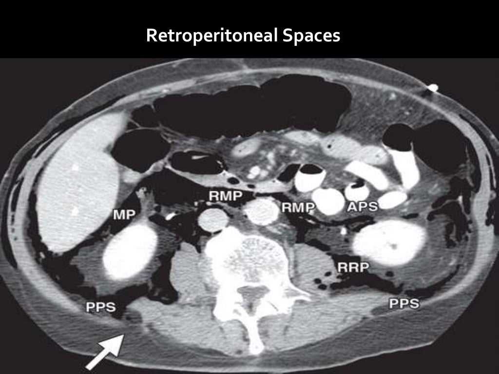 CT ABDOMEN ANATOMY