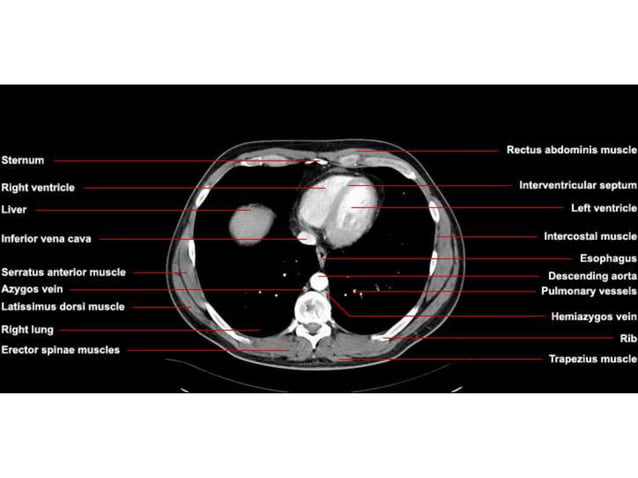 CT Abdomen Axial.pptx