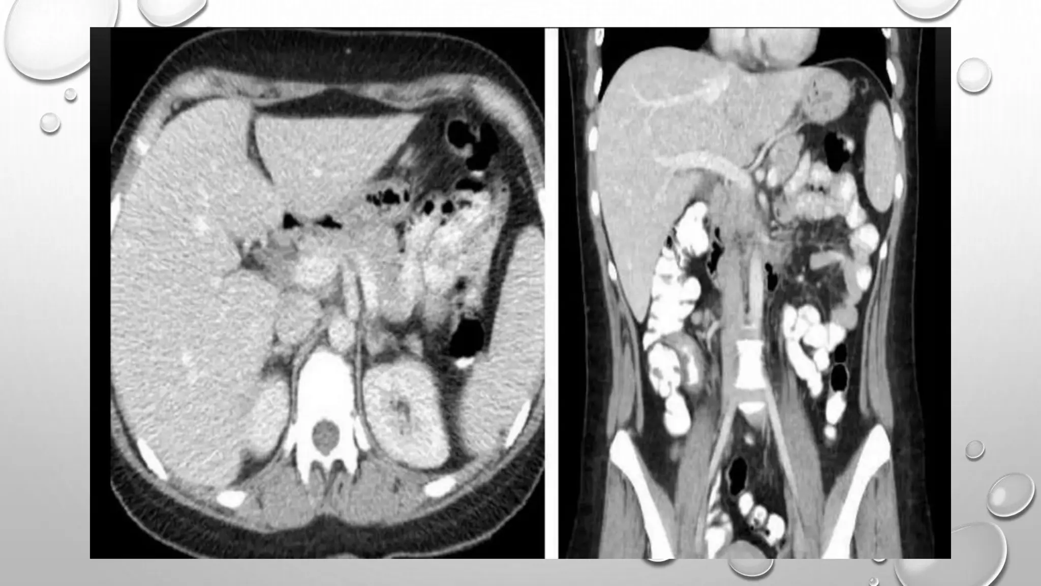 Ct abdomen protocols IMAGING guidelines.pptx
