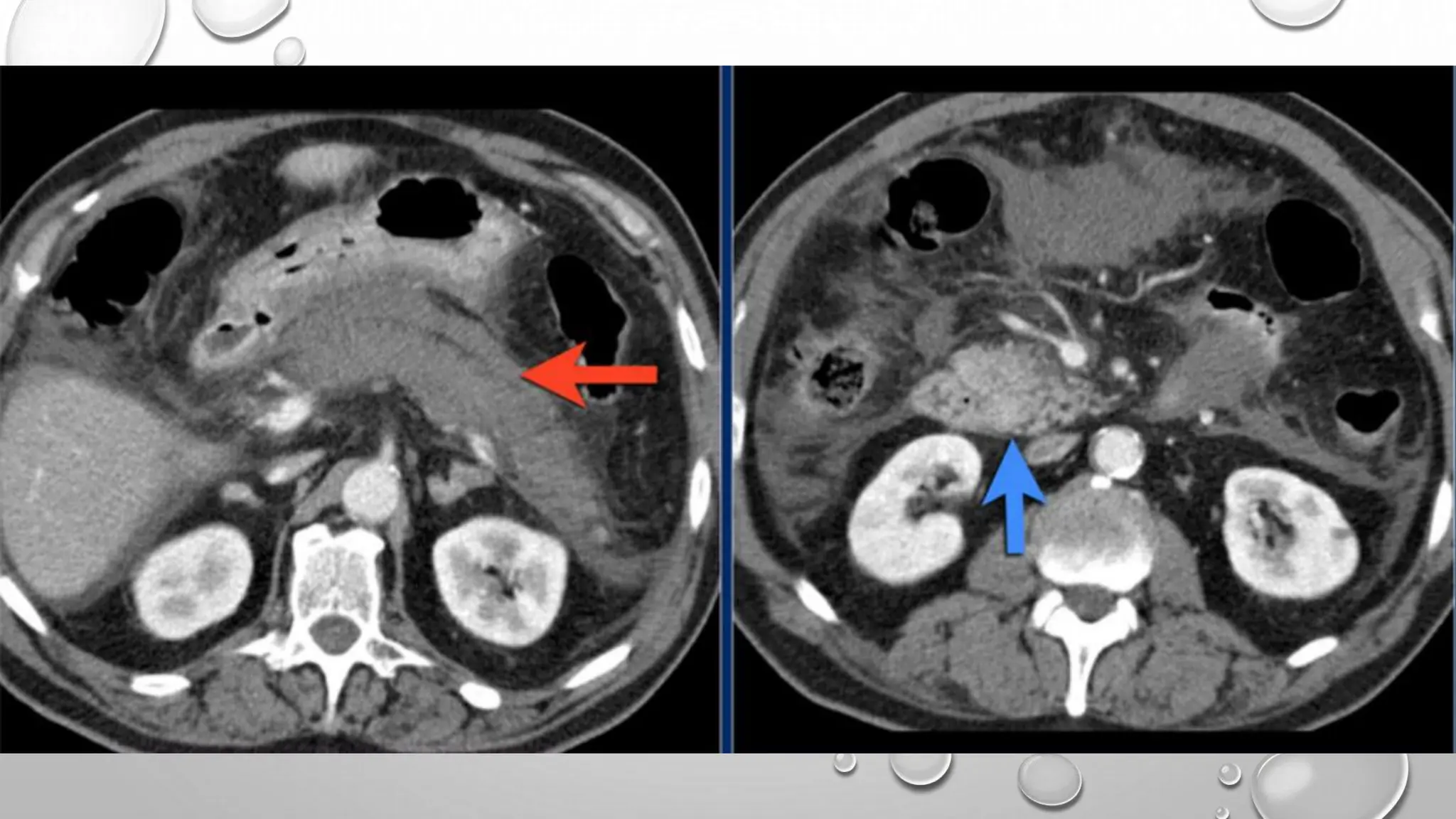 Ct abdomen protocols IMAGING guidelines.pptx