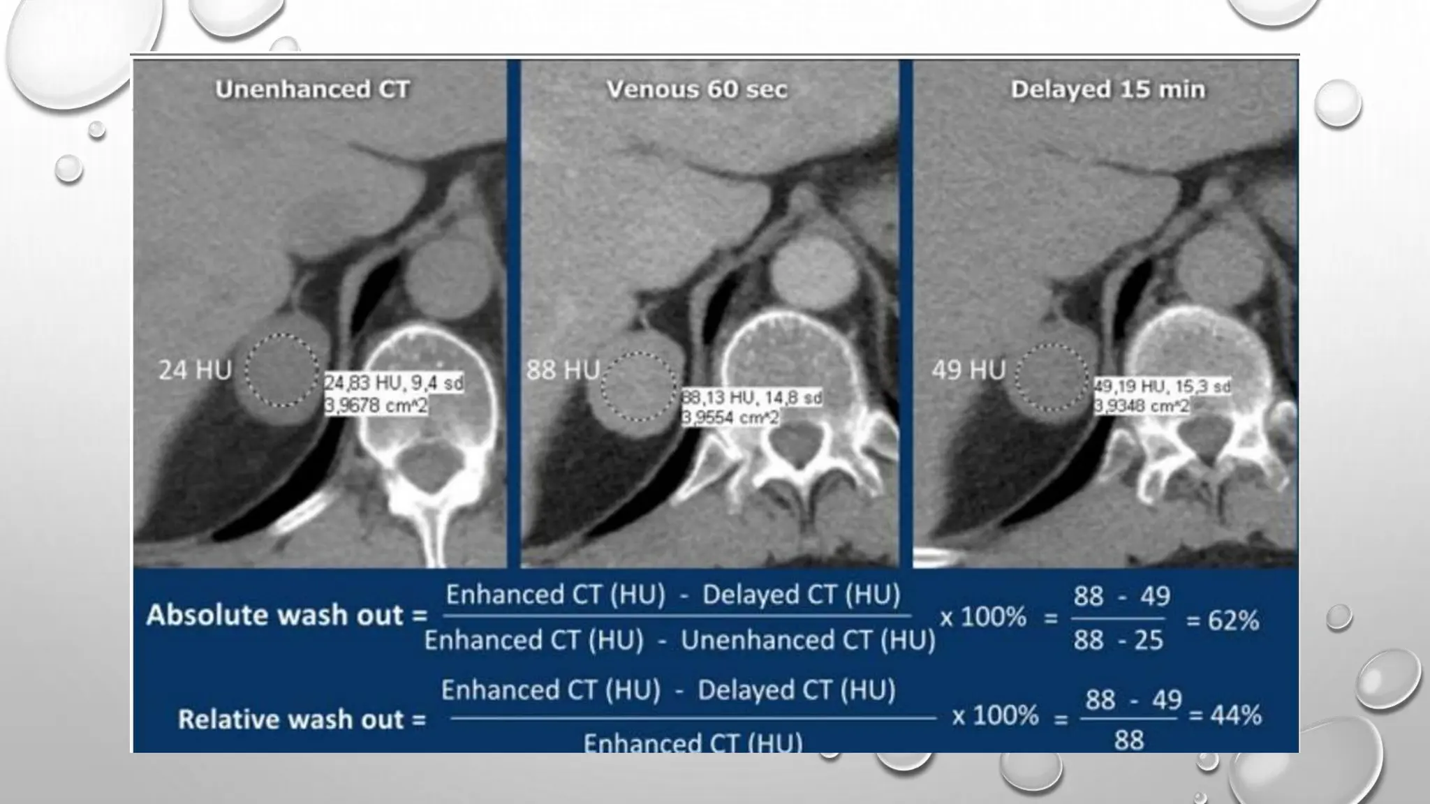 Ct abdomen protocols IMAGING guidelines.pptx