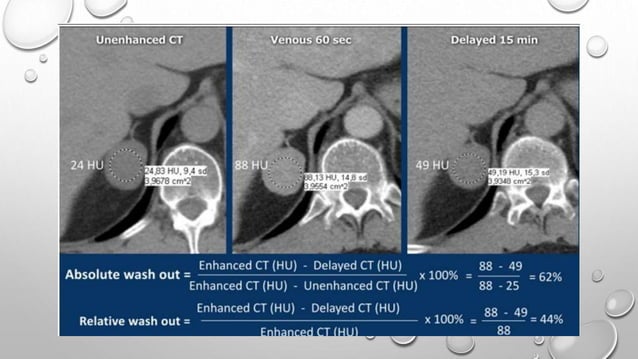 Ct abdomen protocols IMAGING guidelines.pptx