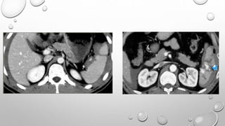 Ct abdomen protocols IMAGING guidelines.pptx
